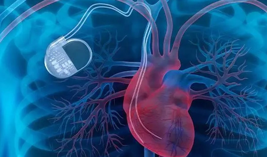 Chinese scientists create world's first lab-grown heart pacemaker ...