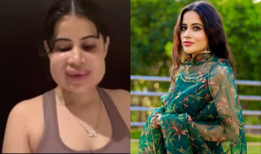 Uorfi Javed opens up about cosmetic reversal | SAMAA TV
